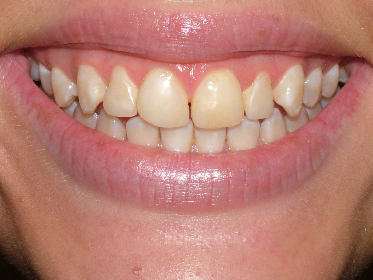 Mottled Smiles | The Smile sPA