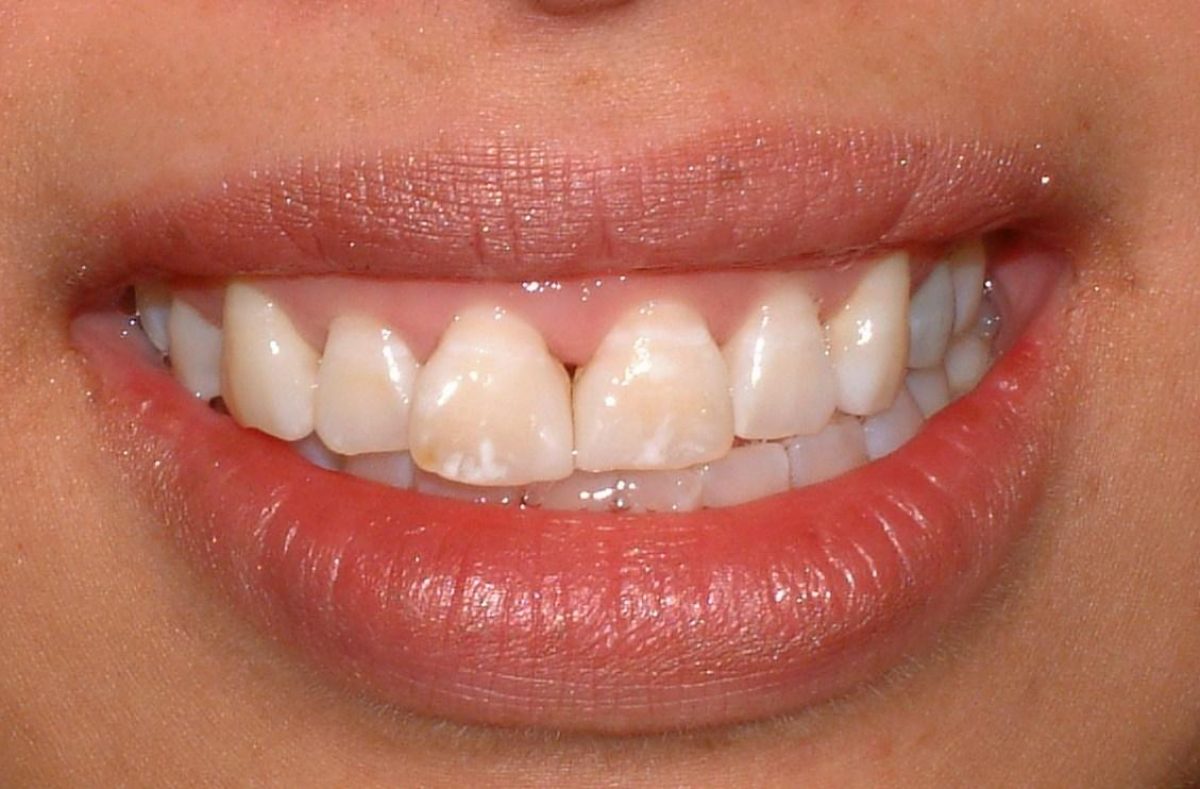 Mottled Smiles | The Smile sPA